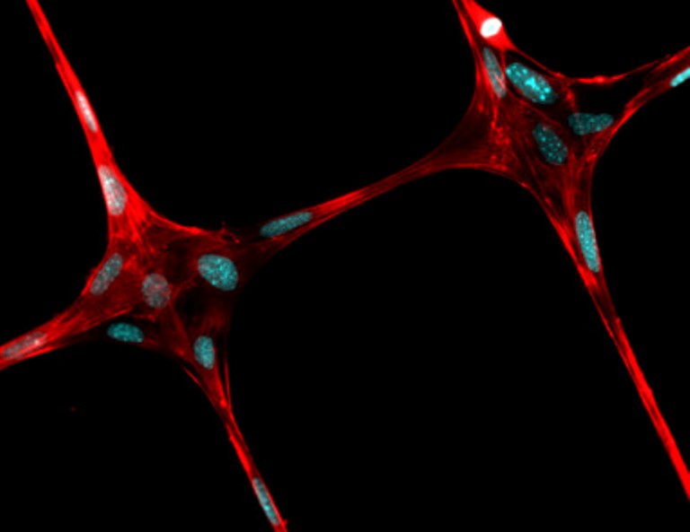 These 3D Printed Fibers Could Help Grow New Body Parts