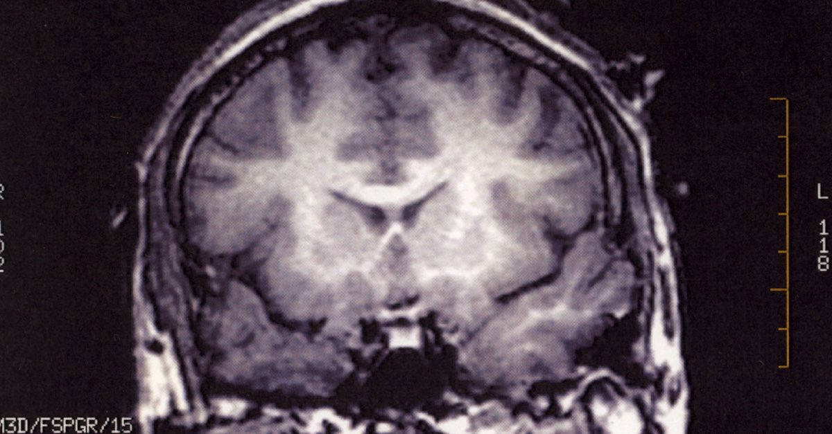 AI Powered Mind-Reading Tech Could Soon Read Your Mind