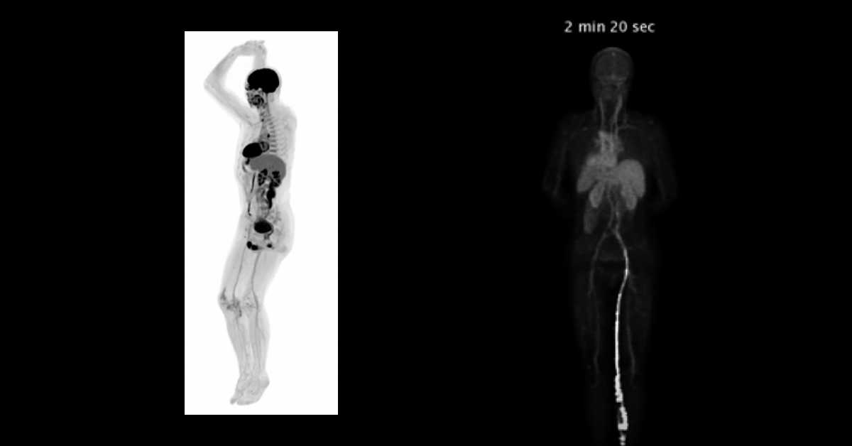The First Human Images by the World's First Total-body Scanner Are Here