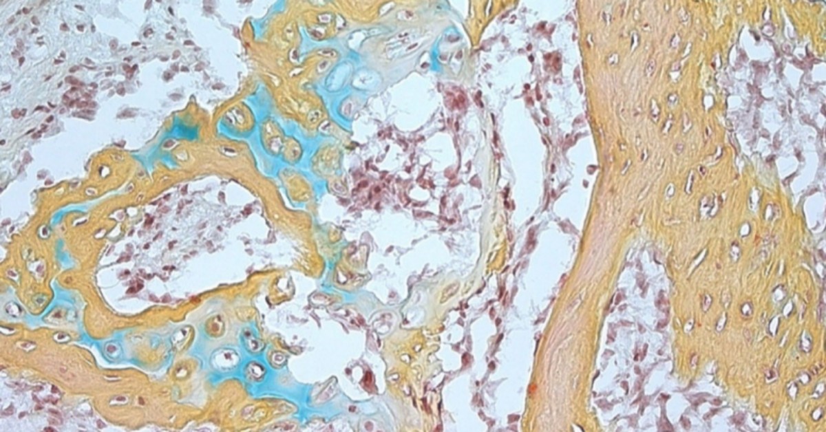 Skeletal Stem Cells That Become Bone and Cartilage Found in Humans for ...
