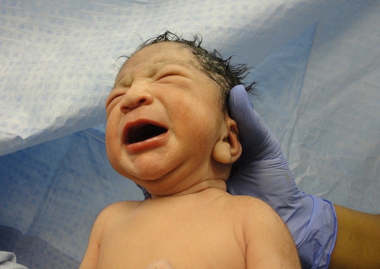 How and Why the Viability Age of Babies Keeps Getting Younger