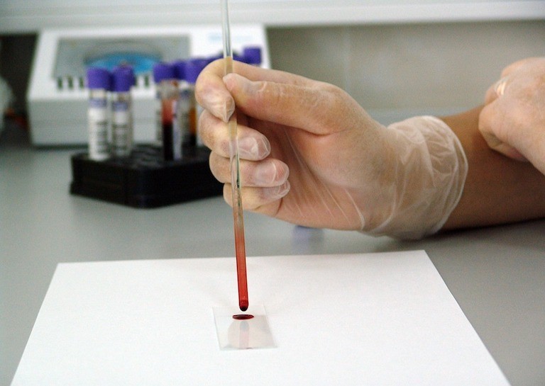 This New Test Can Screen for 13 Types of Cancer Using a Single Drop of ...