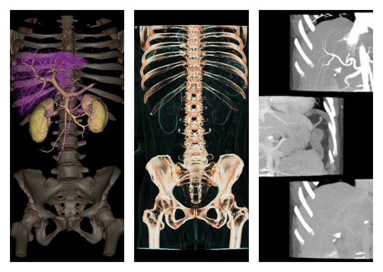 New CT Body Scanner Captures Freakishly High Definition 3D Images