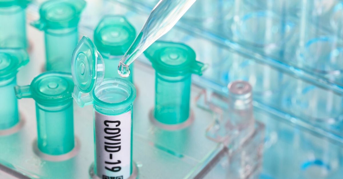 New Lightning-Fast Coronavirus Test Approved for Use, Says FDA