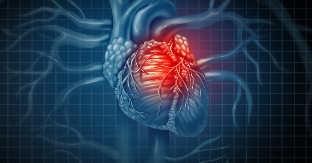 Electrically Active Materials Being Used to Repair Scar Tissue from ...