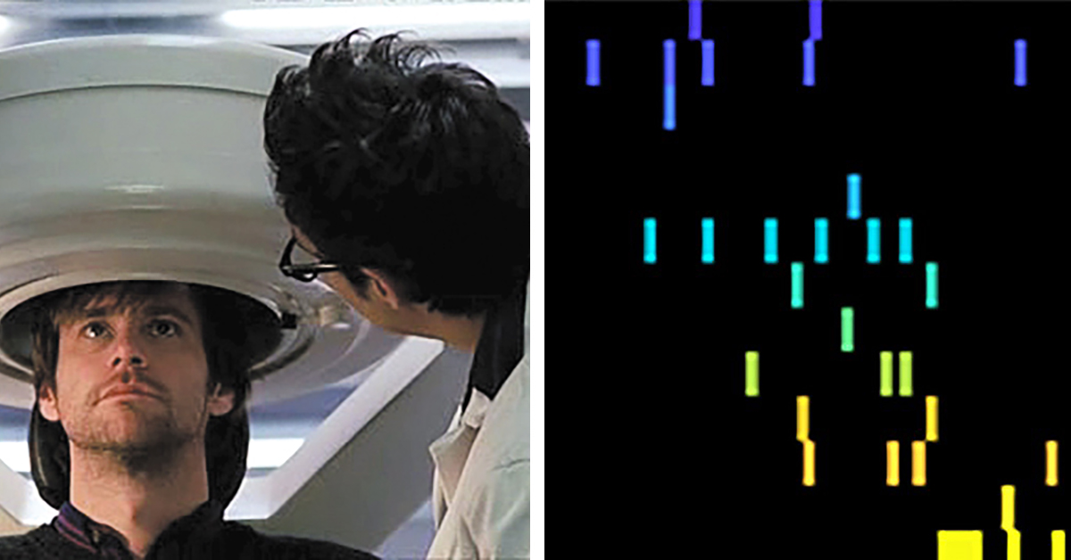 Scientists Monitor Brains Replaying Memories during Epilepsy Study