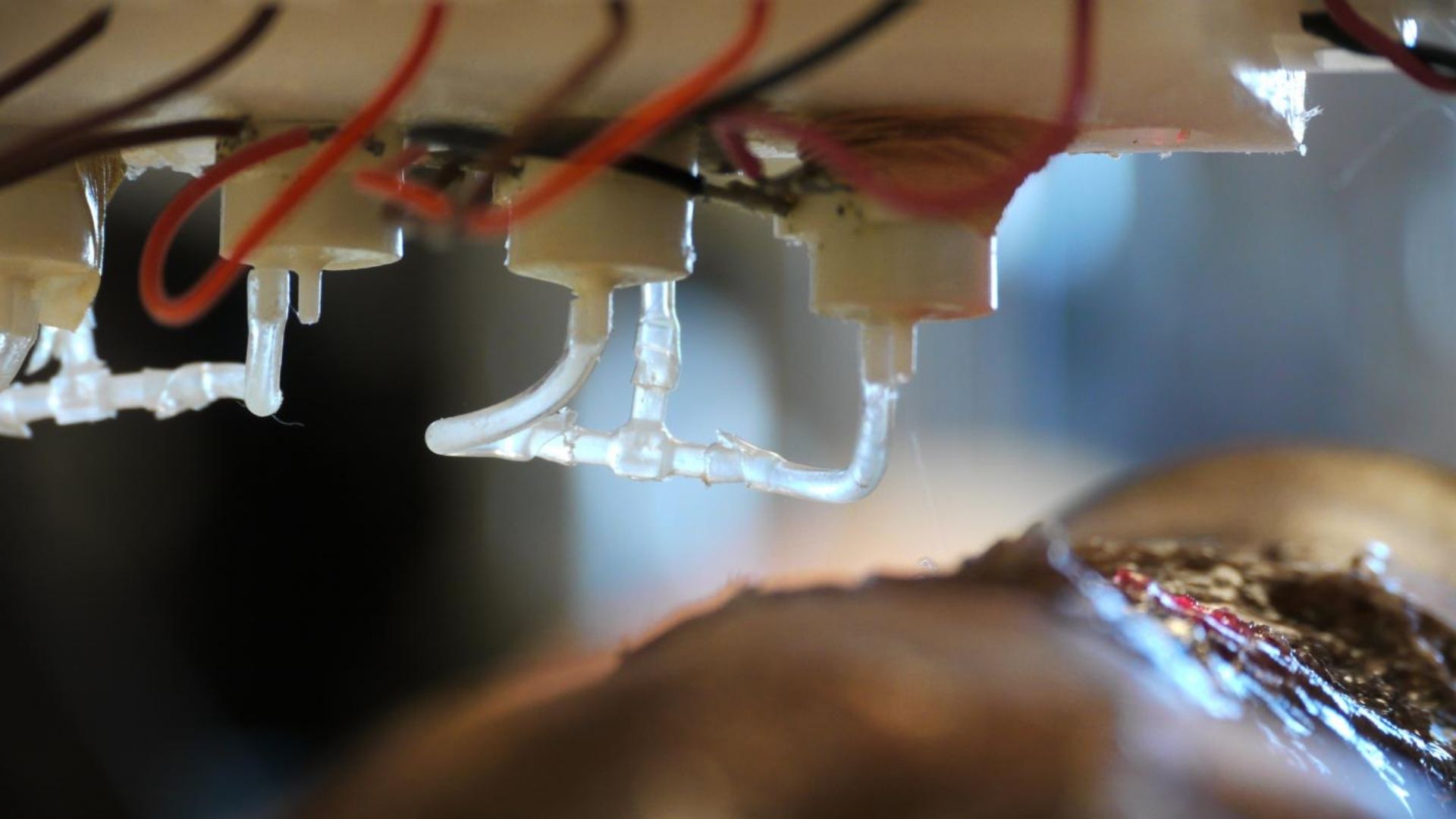 3D Printers Can Already Create Human Body Parts