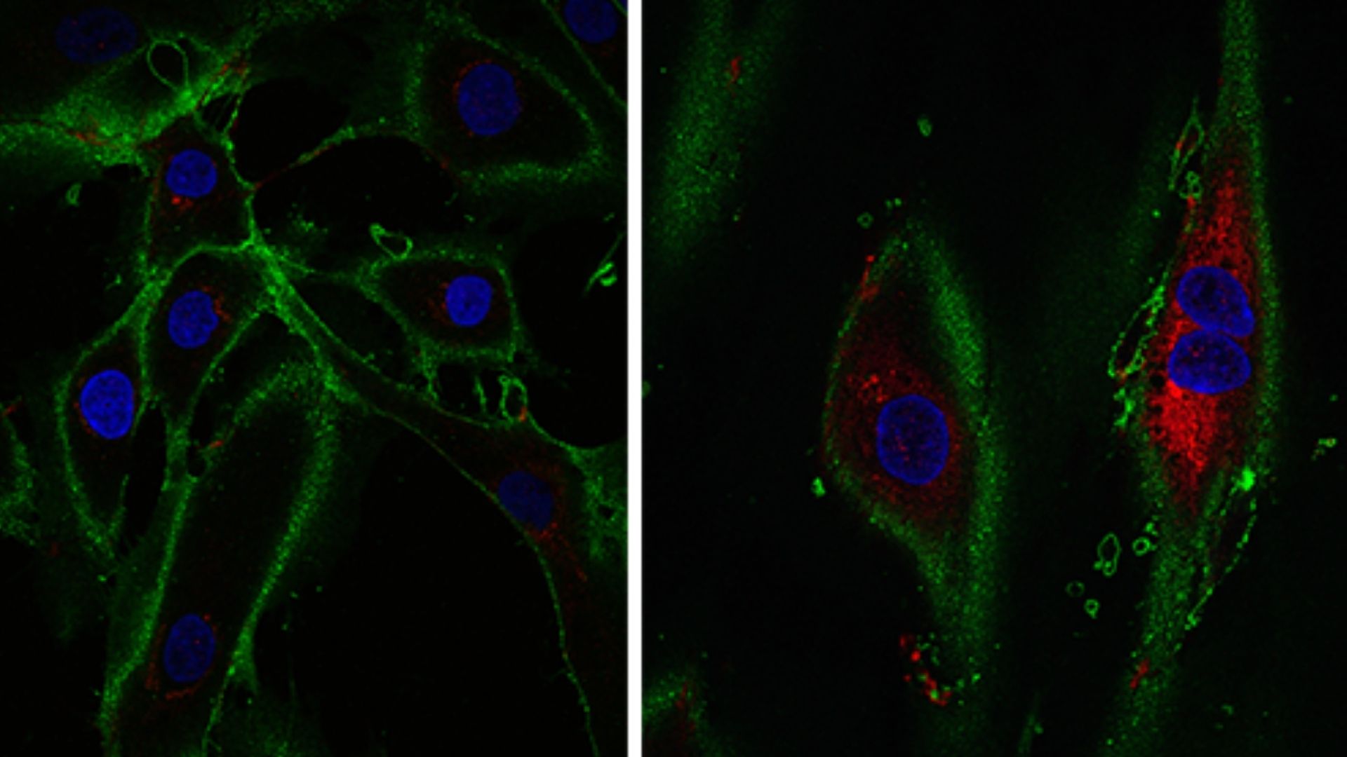 Reverse aging: New anti-aging research enables human cells to "time ...