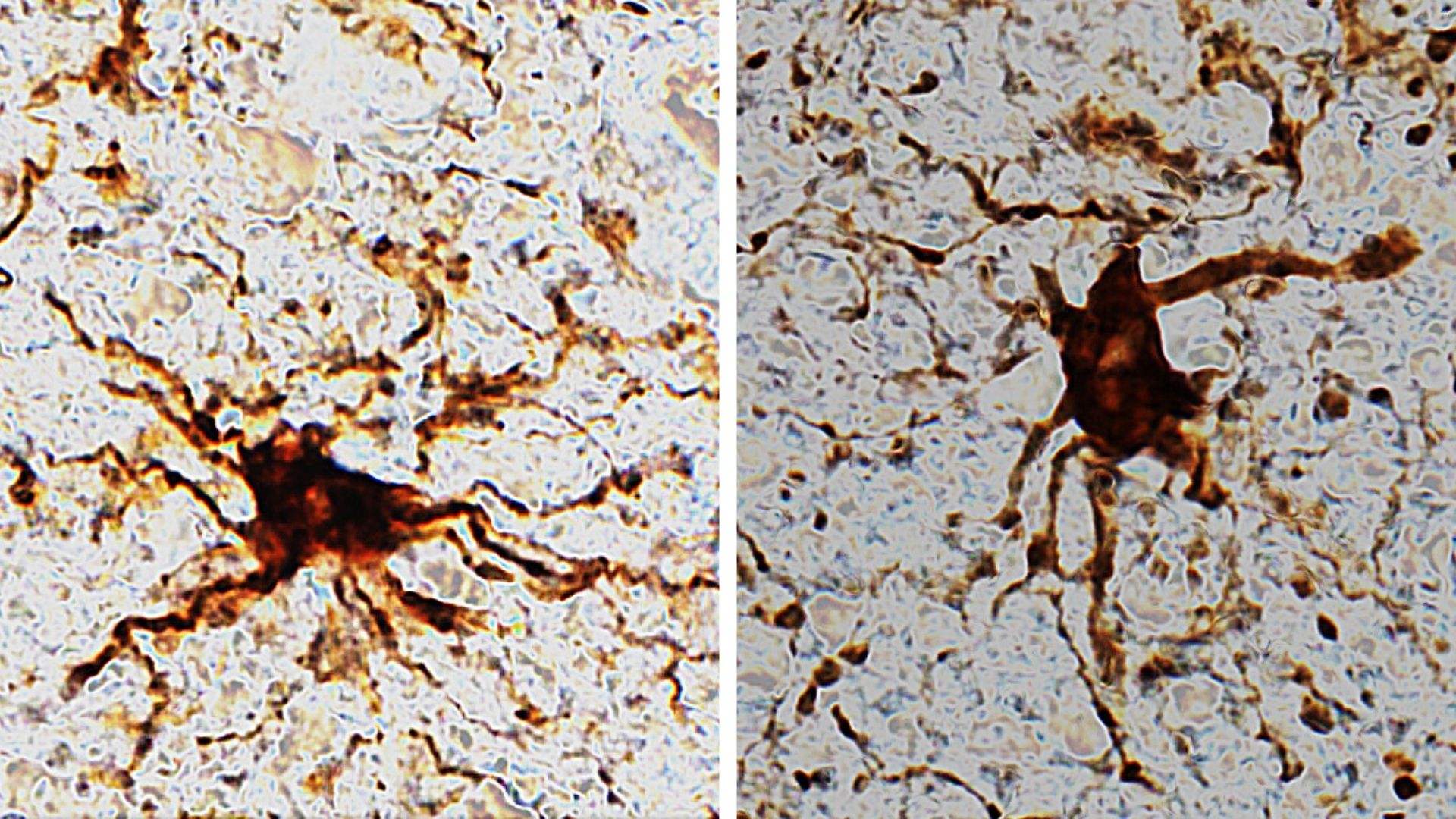 Your Brain Has 'Zombie' Cells That Actually Grow After You Die | IE