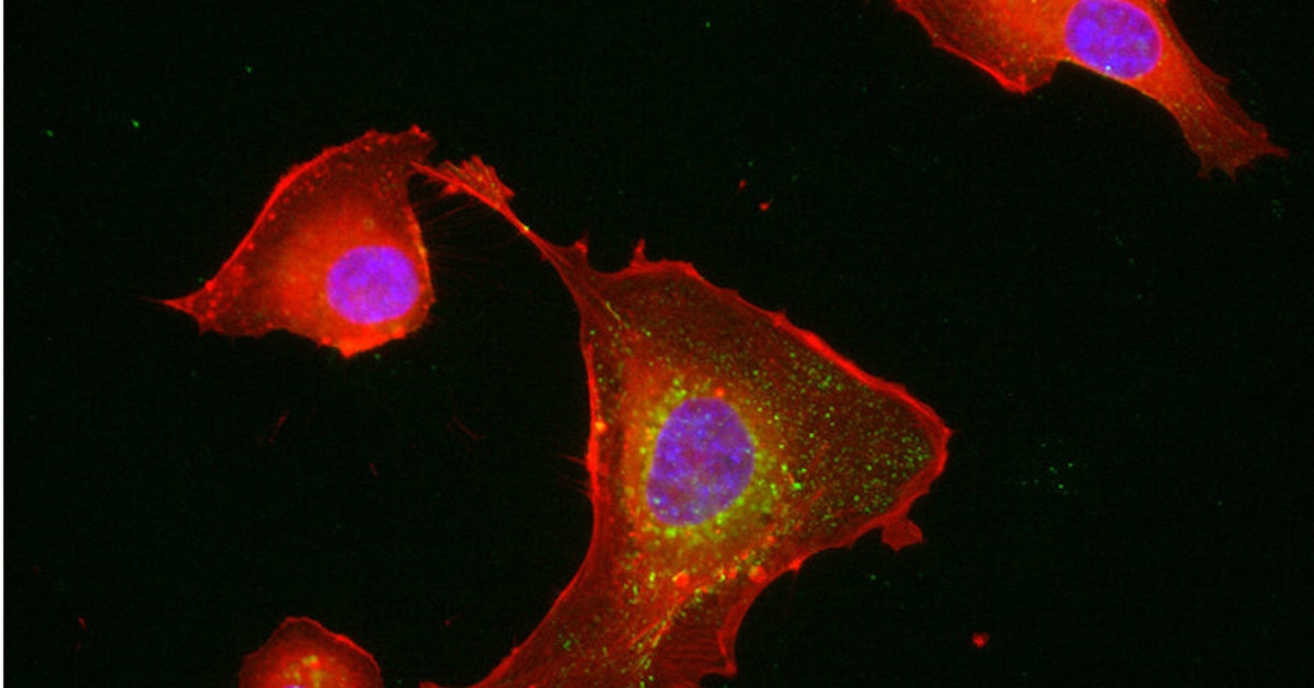 New ESA-Assisted Experiment Grows Human Tissue in Space