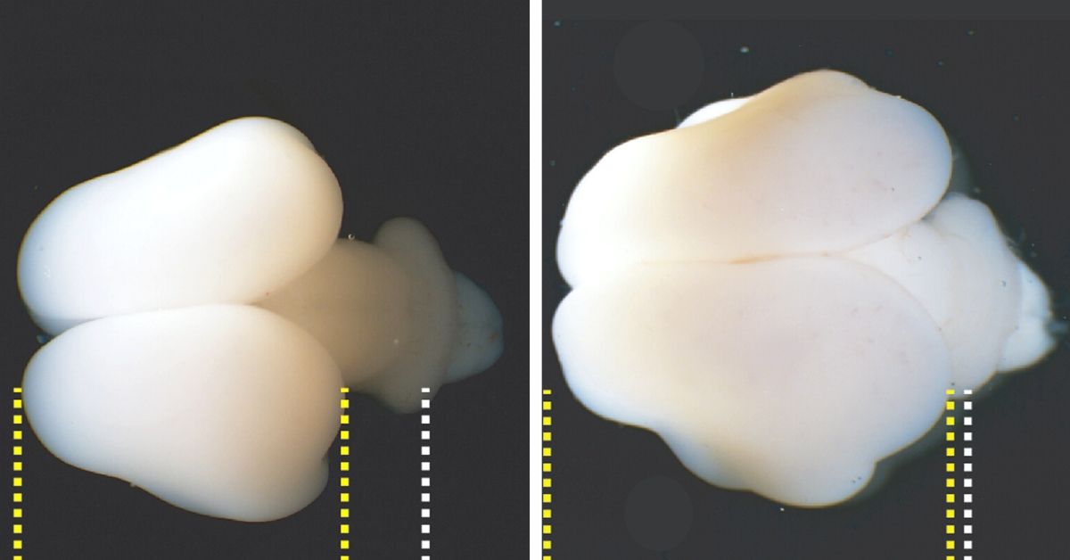 Scientists Grow Bigger Monkey Brains Using Human Genes, Replicating ...